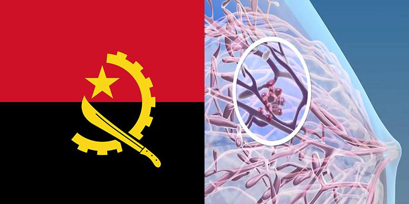 Breast Cancer in Angola