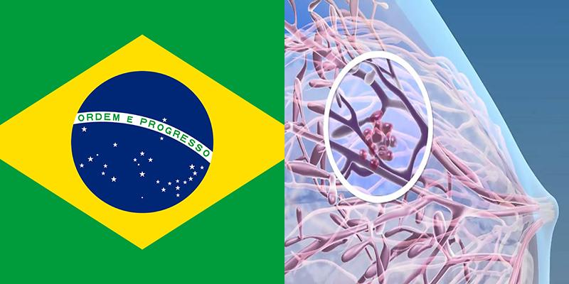 Breast Cancer in Brazil