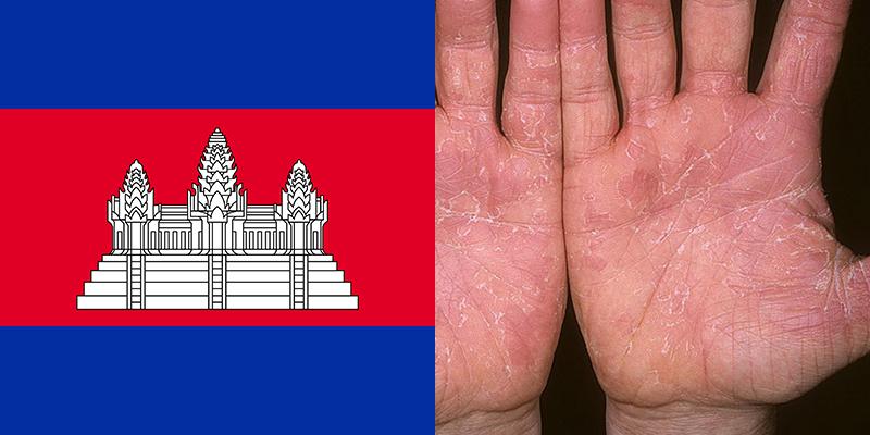 Skin Disease in Cambodia