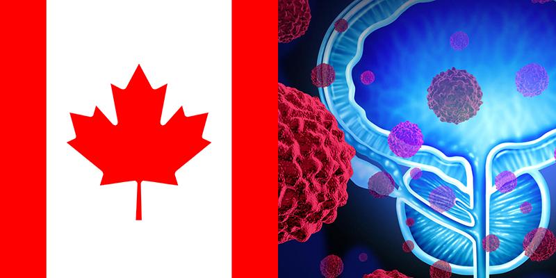 Prostate Cancer in Canada
