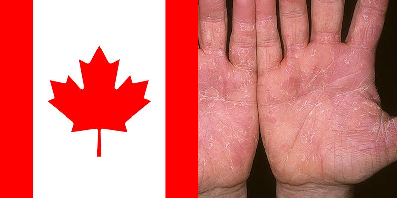 Skin Disease in Canada