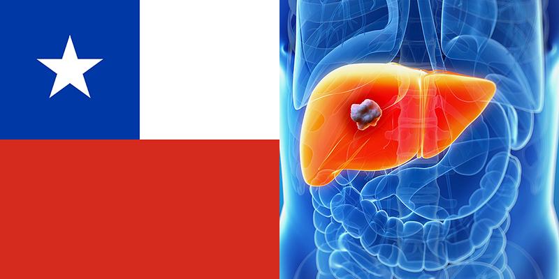 Cáncer de hígado en Chile