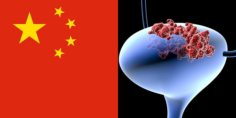 Bladder Cancer in China