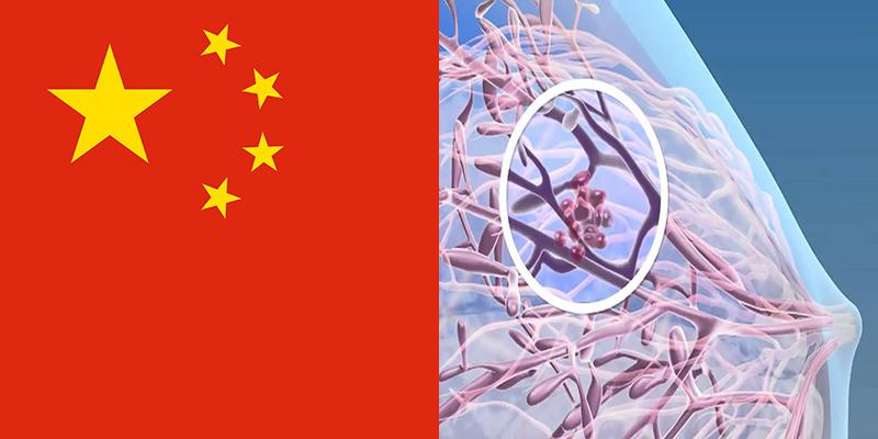 Breast Cancer in China