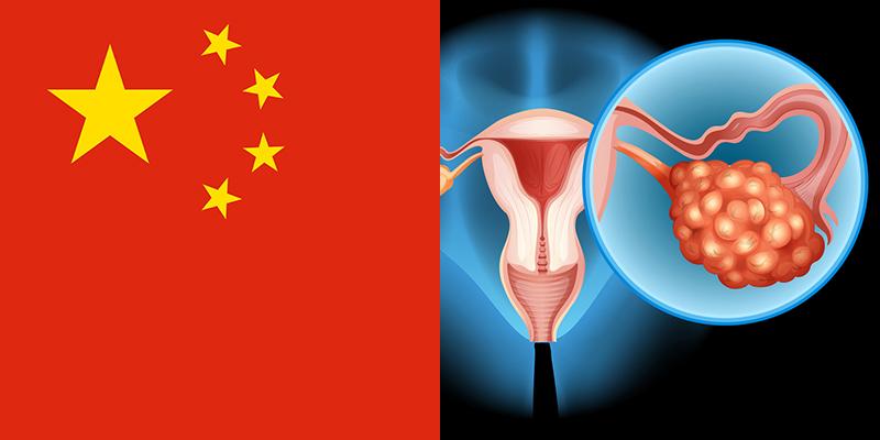 Ovary Cancer in China