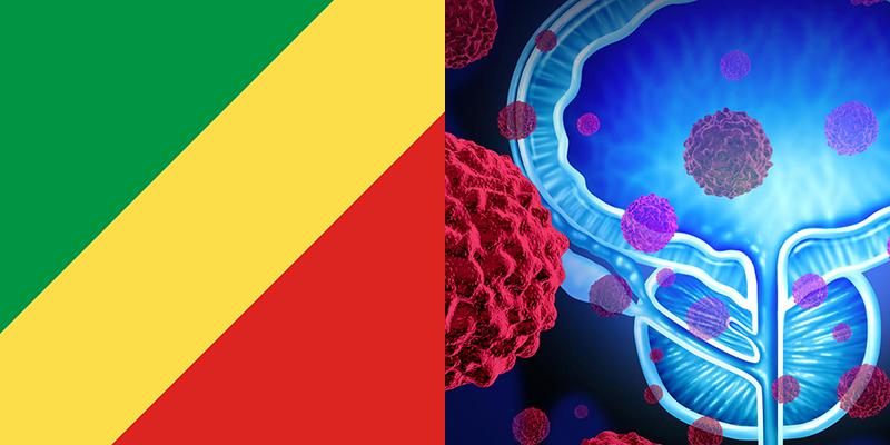 Prostate Cancer in Congo