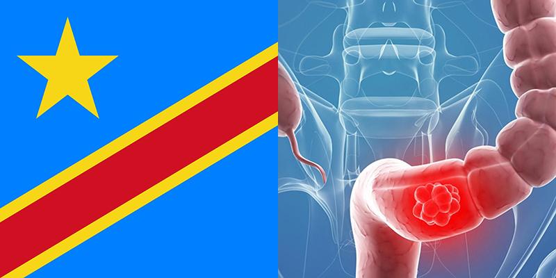 Cancers du colon et du rectum en RD Congo