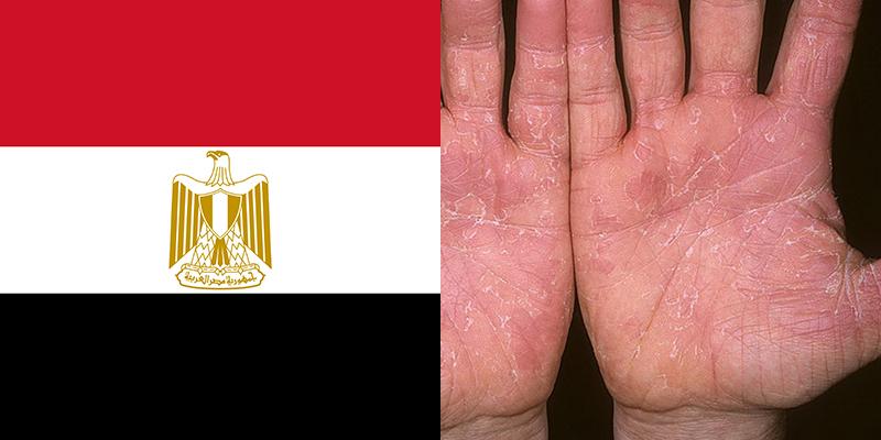 Skin Disease in Egypt