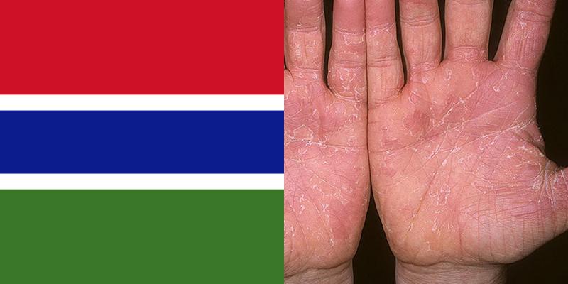 Skin Disease in Gambia