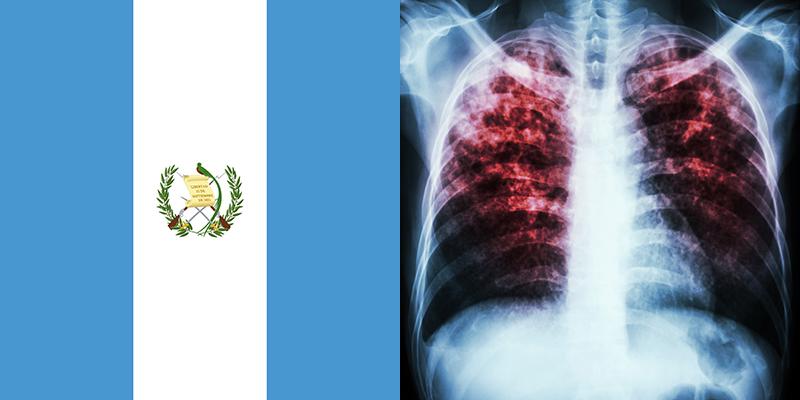Tuberculosis en Guatemala
