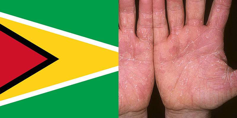 Skin Disease in Guyana