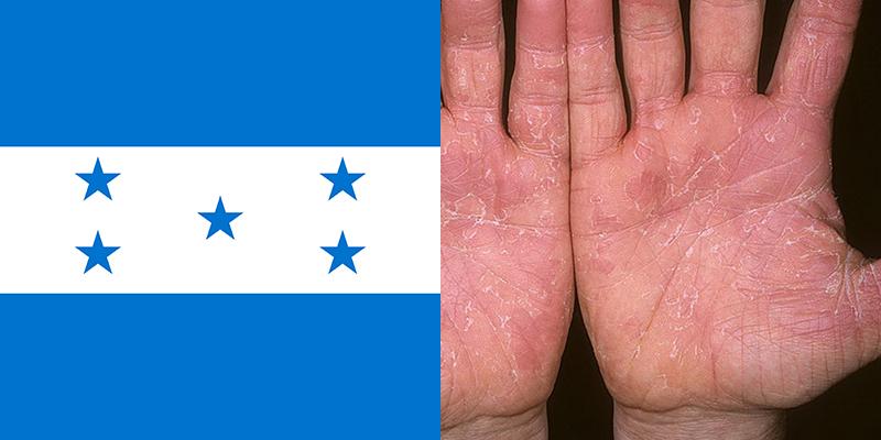 Skin Disease in Honduras