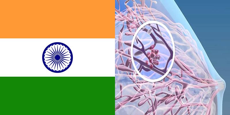 Breast Cancer in India