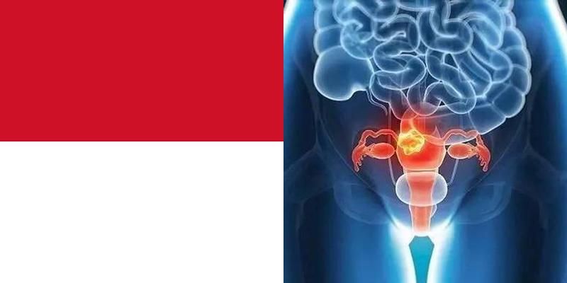 Cervical Cancer in Indonesia