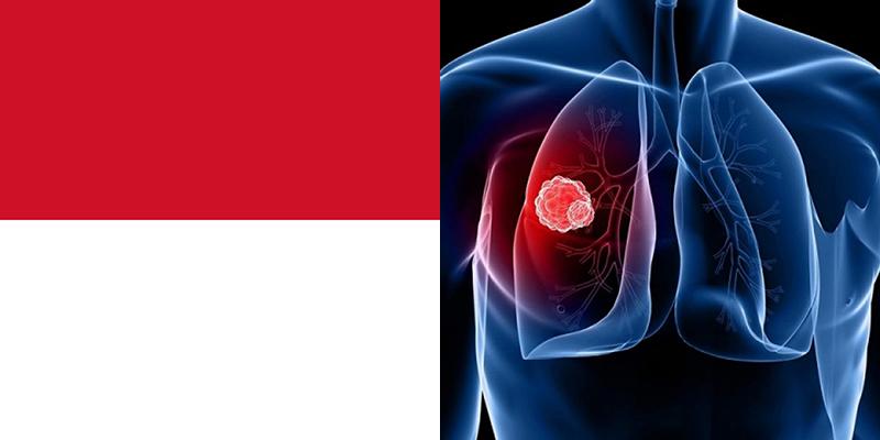 Lung Cancers in Indonesia