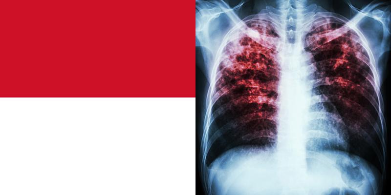 Tuberculosis in Indonesia