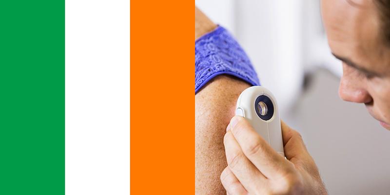 Skin Cancers in Ireland