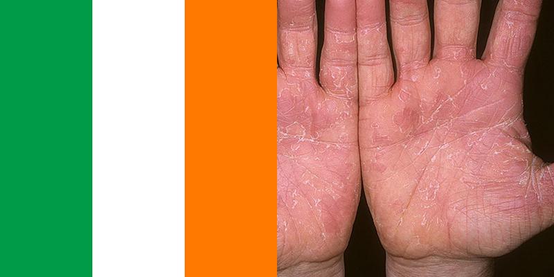 Skin Disease in Ireland