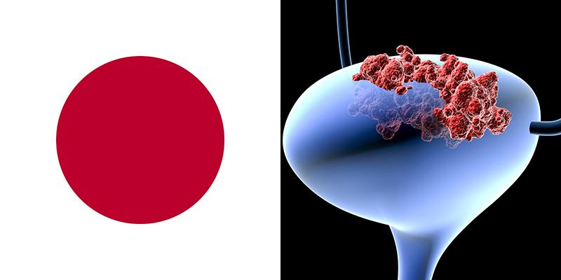 Bladder Cancer in Japan