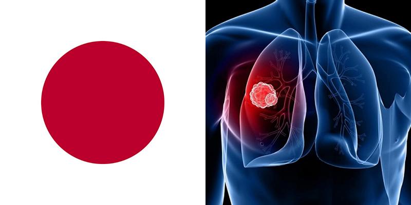 Lung Cancers in Japan