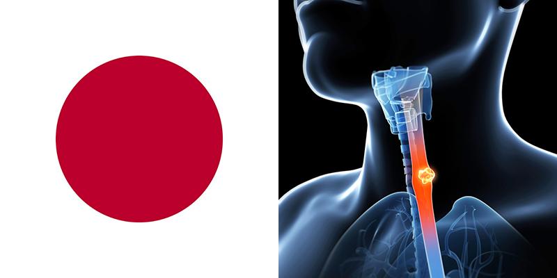 Oesophagus Cancer in Japan