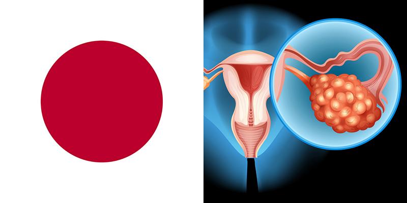 Ovary Cancer in Japan