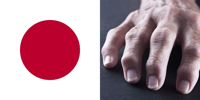 Rheumatoid Arthritis in Japan