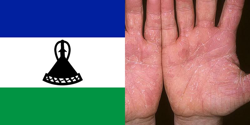 Skin Disease in Lesotho