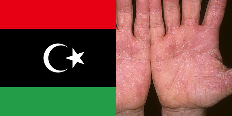 리비아에서 피부병