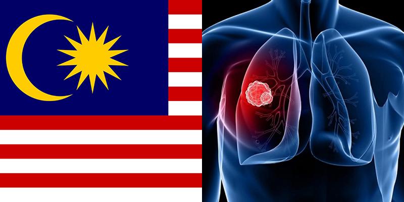 Lung Cancers In Malaysia