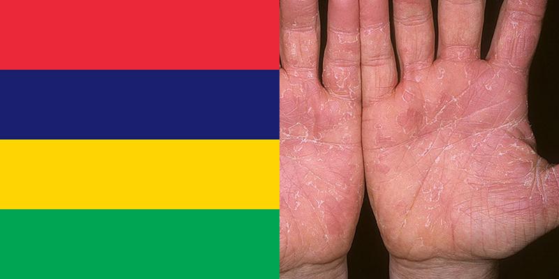 Skin Disease in Mauritius