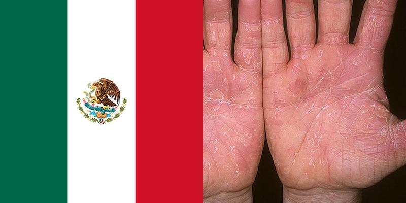 Skin Disease in Mexico