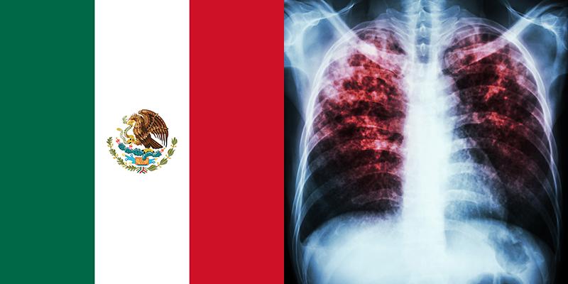 Tuberculosis en México