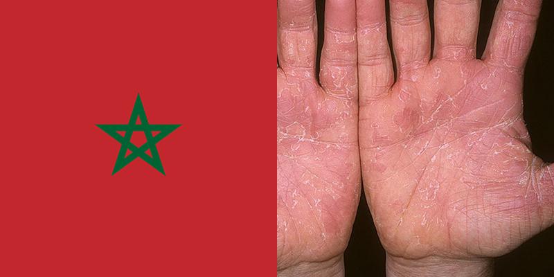 Skin Disease in Morocco