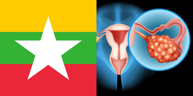 Ovary Cancer in Myanmar