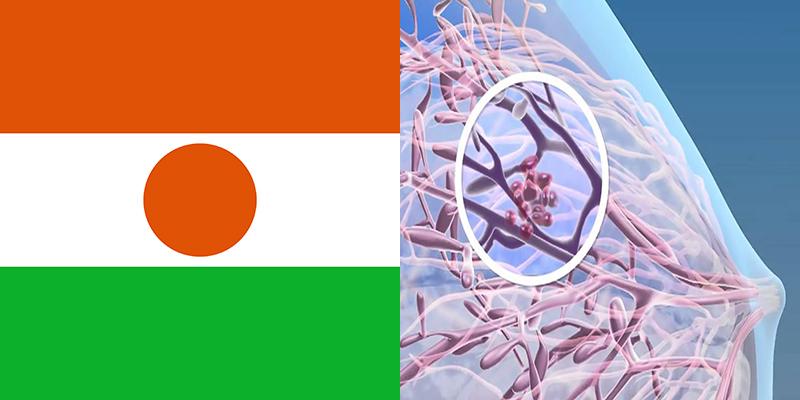 Kanker payudara di Niger