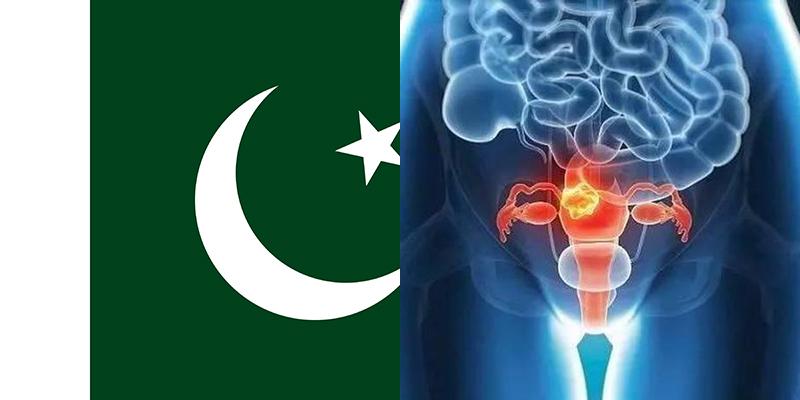 Cervical Cancer in Pakistan