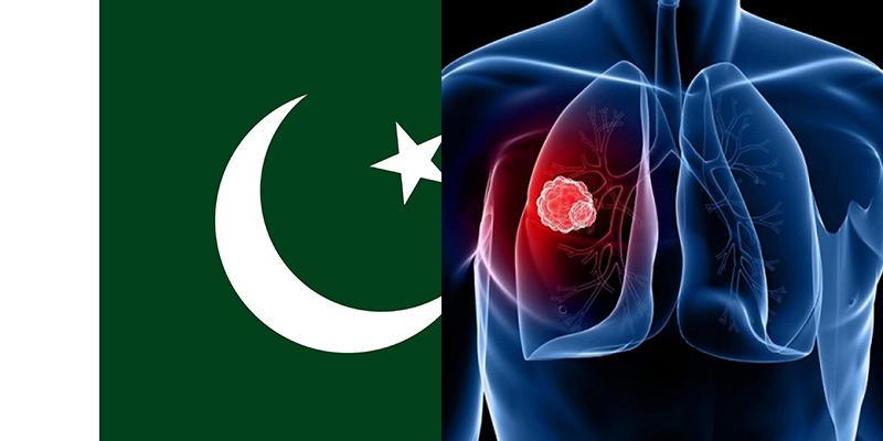 Lung Cancers in Pakistan
