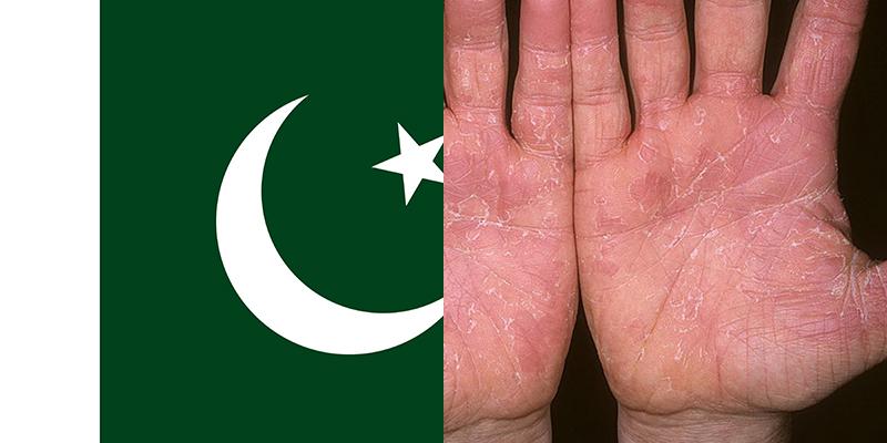 Skin Disease in Pakistan