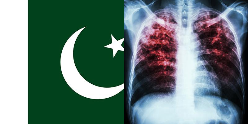 Tuberculosis in Pakistan