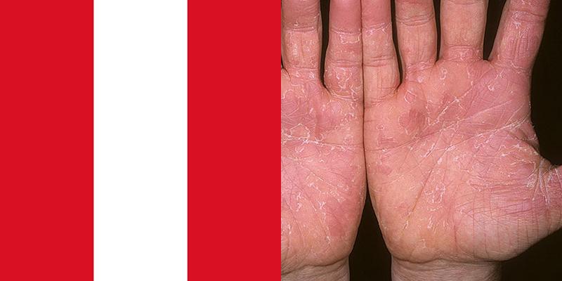 Skin Disease in Peru
