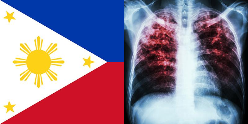 Tuberculosis in Philippines