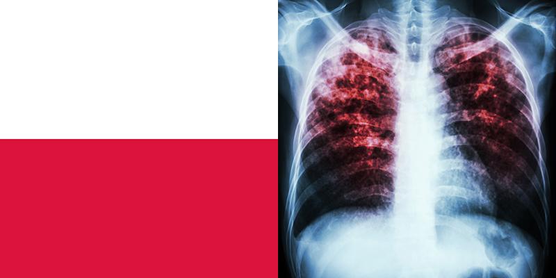 Tuberculosis in Poland