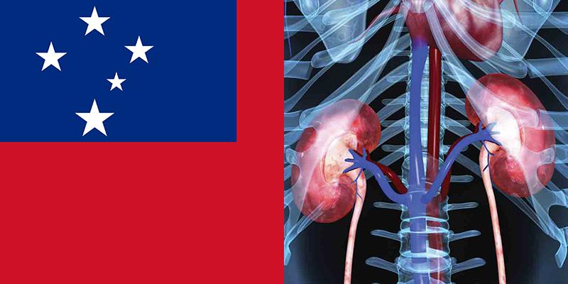 사모아에서 신장병