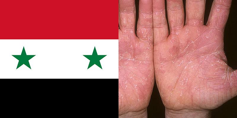 Skin Disease in Syria
