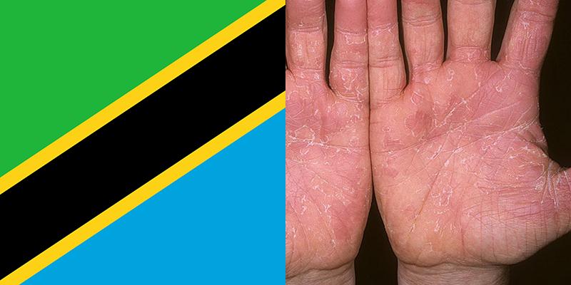 Skin Disease in Tanzania