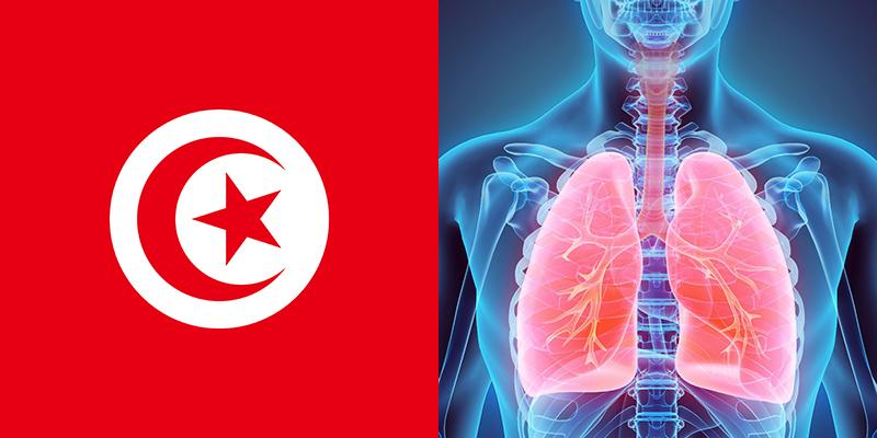 튀니지에서 폐 질환
