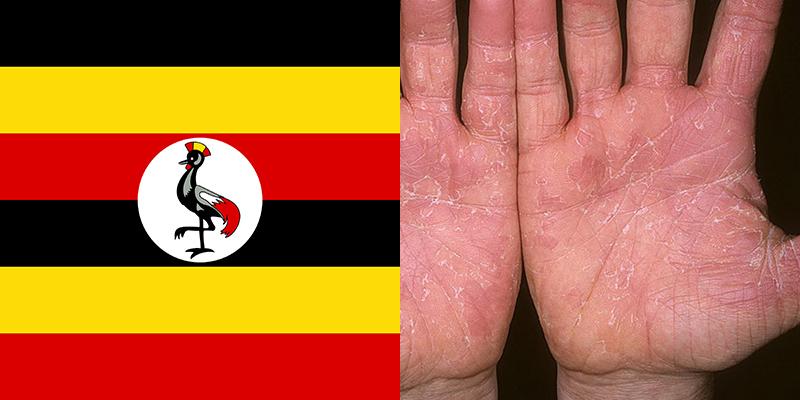 Skin Disease in Uganda