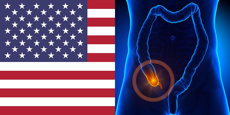 Appendicitis in United States