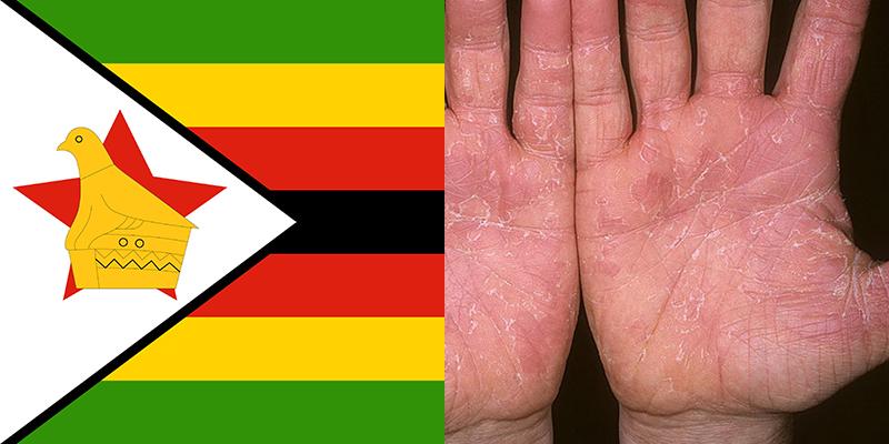Skin Disease in Zimbabwe